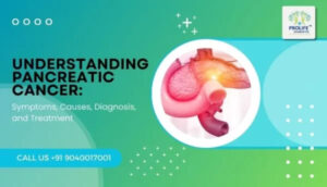 Understanding Pancreatic Cancer: Symptoms, Causes, Diagnosis, and ...