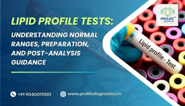 Lipid Profile Tests: Understanding Normal Ranges, Preparation, and Post ...