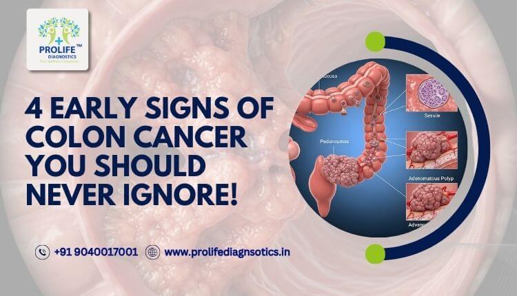 Blogs on Prolife Diagnostics